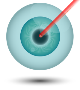 YAG PCO (Post-Cataract Surgery Haze) – Peel Vision